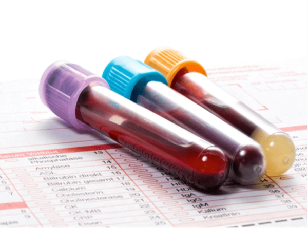 Lab Testing - Phil Richards Nutrition Lab